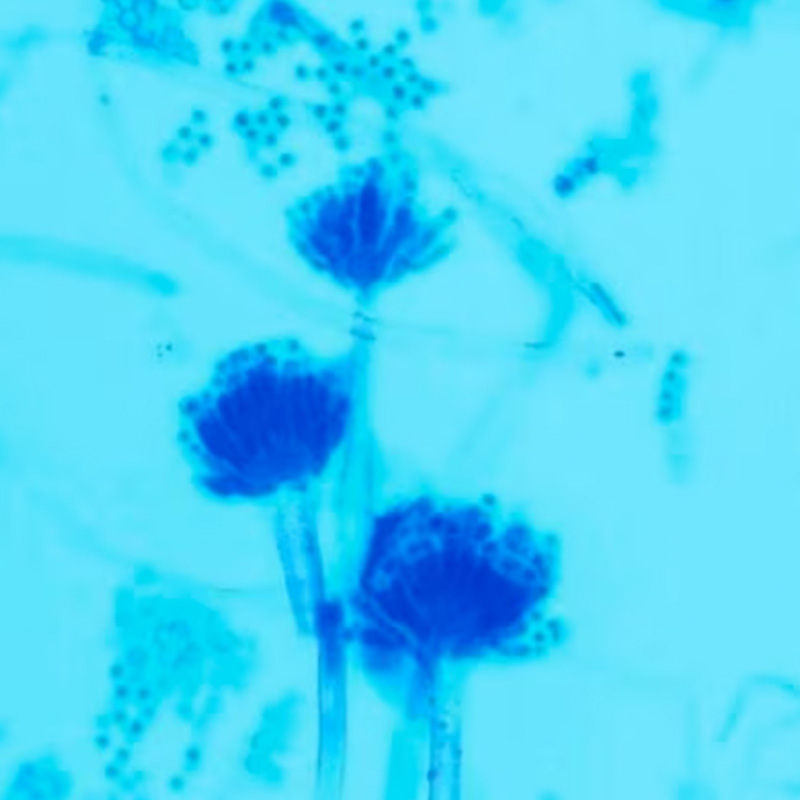 Lactophenol blue solution for staining fungi - Labchem Catalog